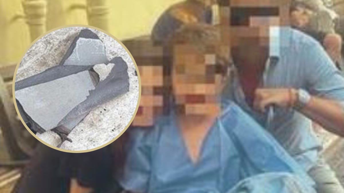Rzym: 10-letni chłopiec z Polski miał groźny wypadek na wakacjach Rzym: 10-letni chłopiec z Polski miał groźny wypadek na wakacjach